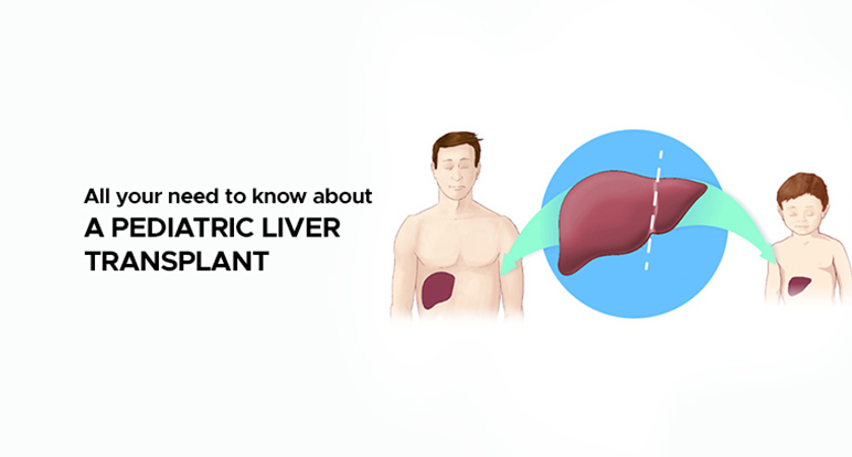 Pediatric Liver Transplant: Techniques and Complications