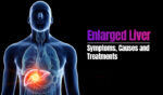 Liver Enlarged In Size - Symptoms, Causes and Treatments