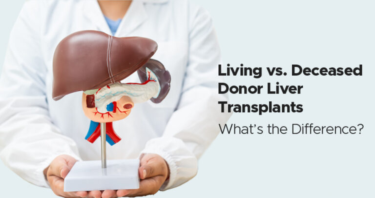 Living vs. Deceased Donor Liver Transplants